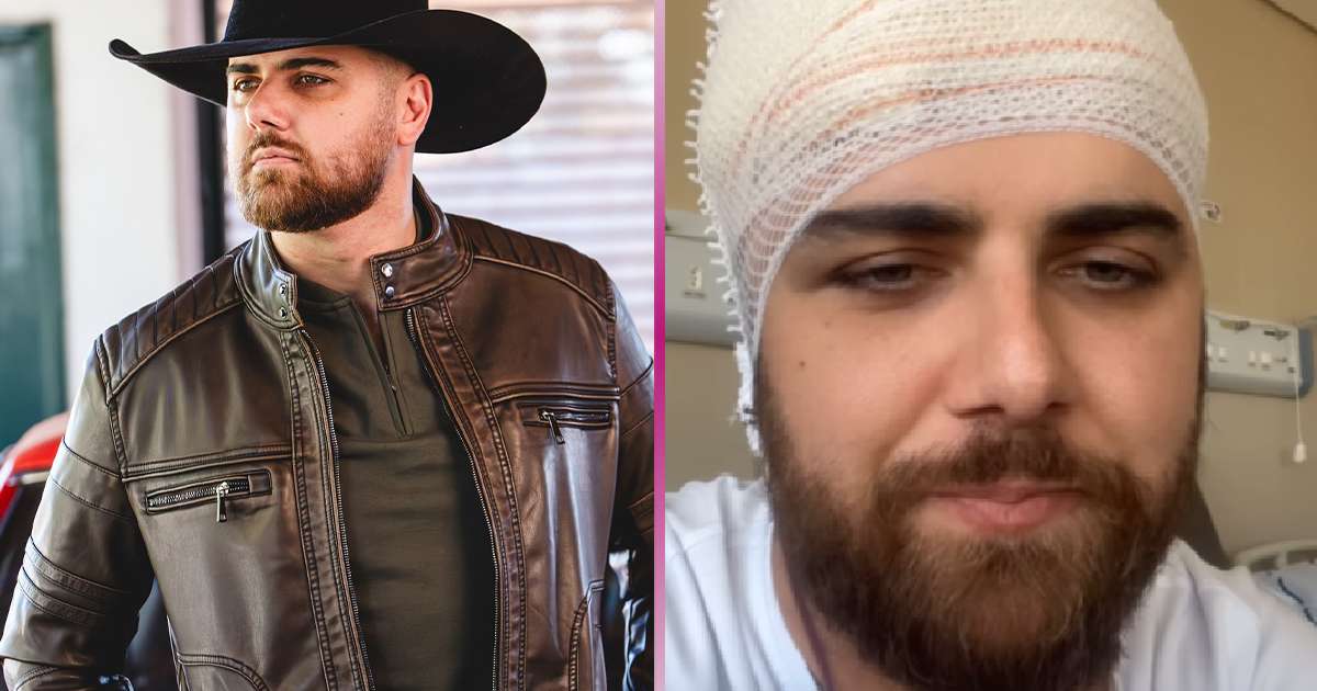 Zé Neto surge com olho roxo e atualiza estado de saúde após acidente