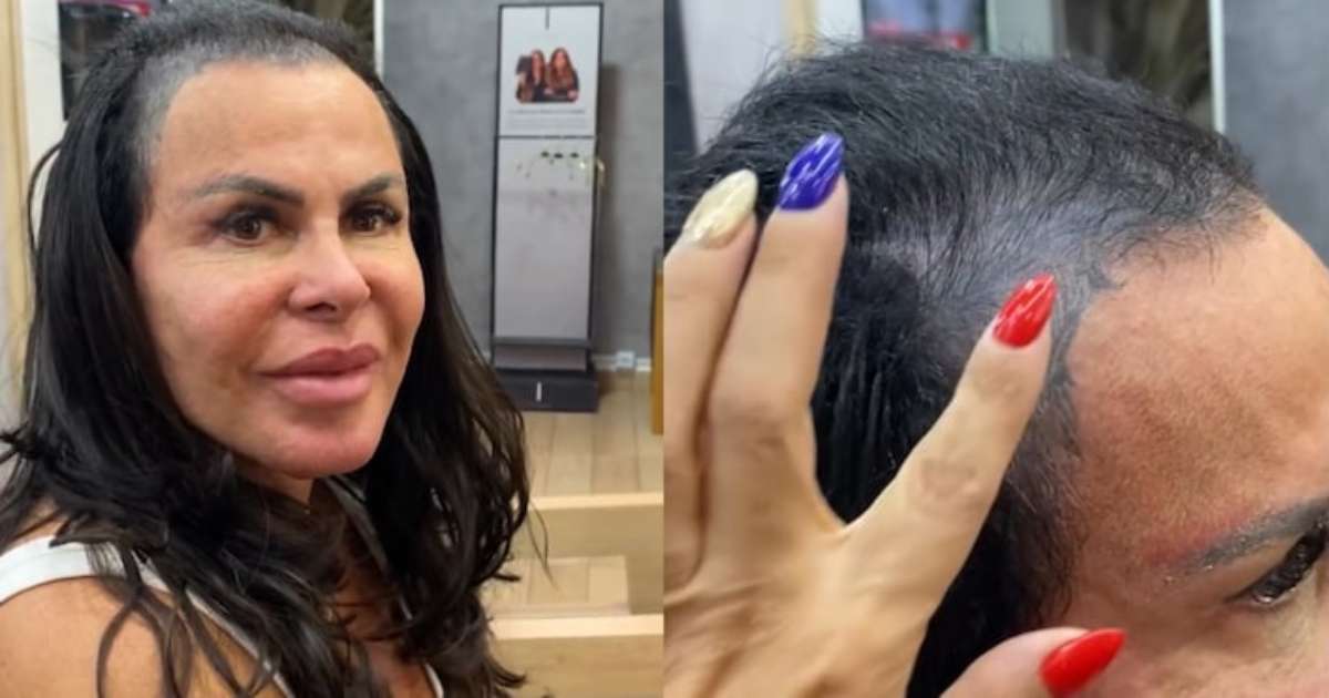 'Perdi todo o cabelo', revela Gretchen ao aparecer sem prótese capilar ...