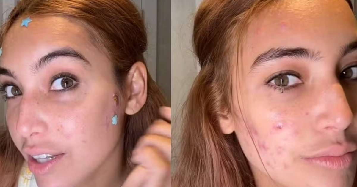 Vanessa Lopes revela como está cuidando da pele em meio a tratamento ...