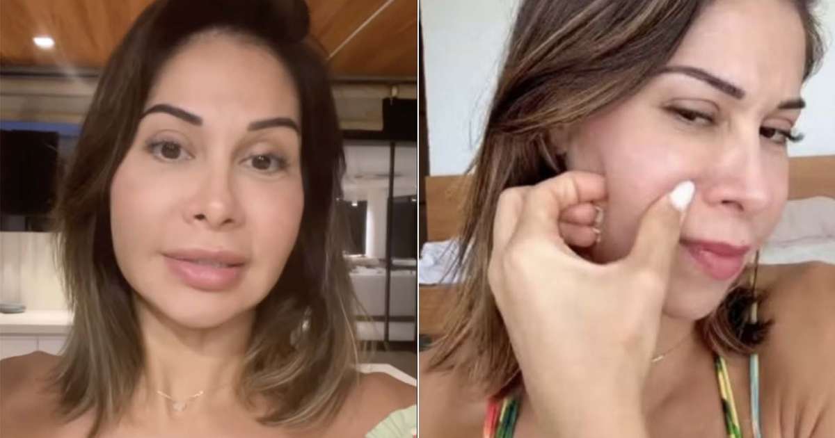 Maíra Cardi revela que passará por cirurgia no rosto. Entenda o motivo