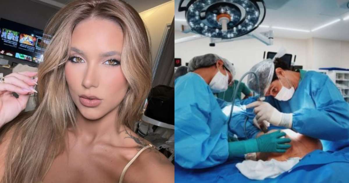 Lipo HD causou hérnia em Virginia? Especialista esclarece caso da ...