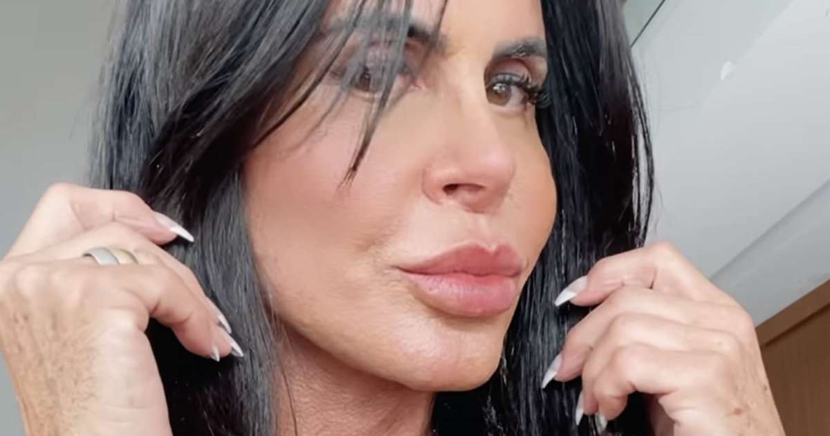 Gretchen, que tem alopecia, aparece sem mega hair: 'Faço questão que ...
