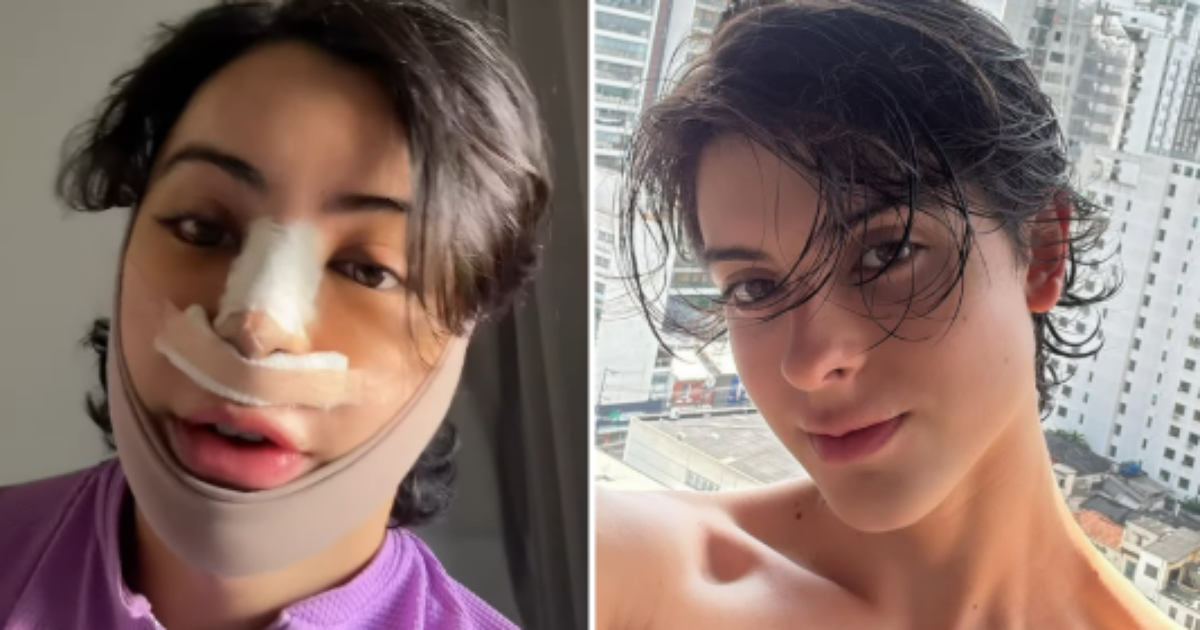 Zé Longuinho admite ter pago R$ 110 mil em feminização facial