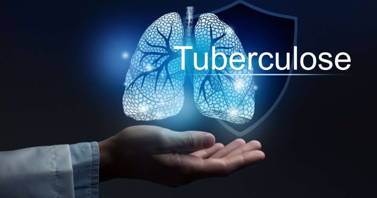 5 sintomas de alerta para a tuberculose