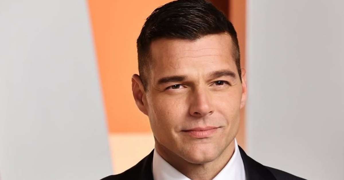Especialista explica procedimento que rejuvenesceu Ricky Martin ...