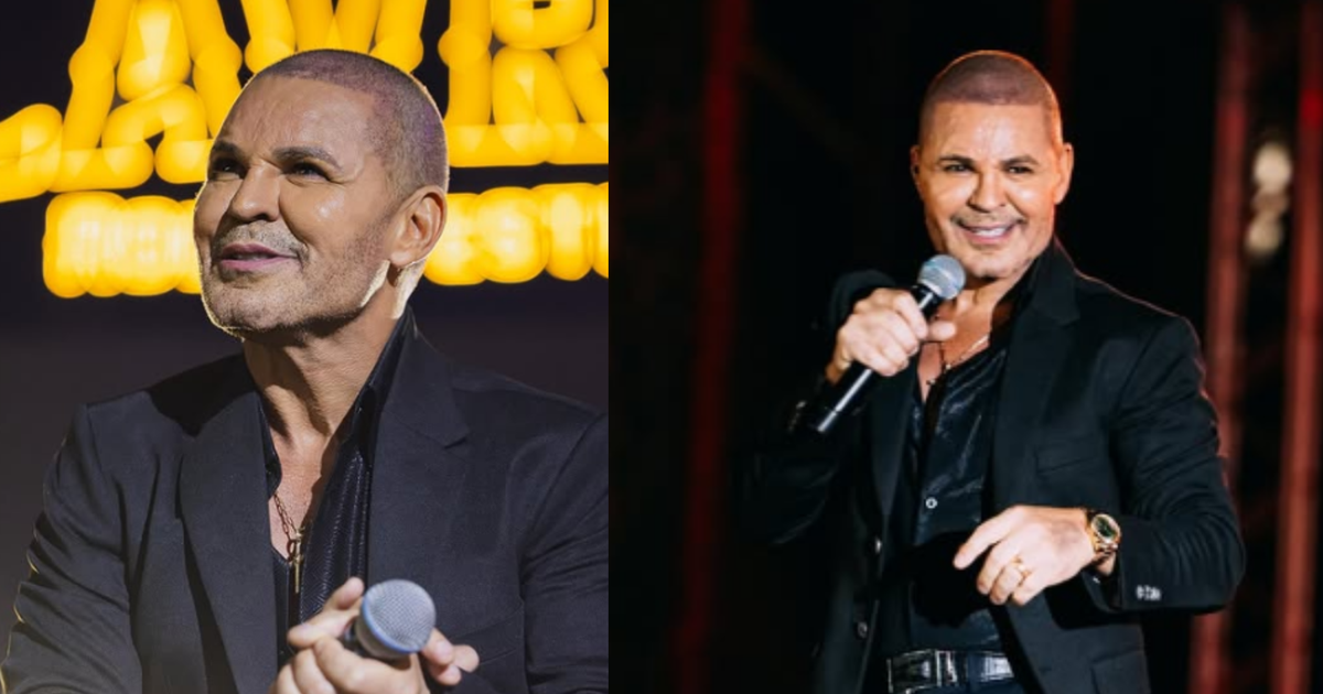 Especialista analisa caso de Eduardo Costa após cantor surgir careca: 'É crucial'