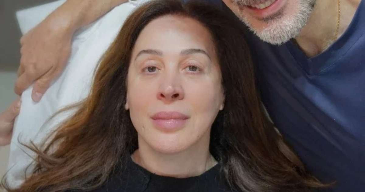 O que são fios de colágeno que Claudia Raia colocou para melhorar a flacidez no rosto?