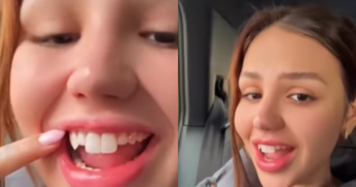 Famosa influenciadora surpreende seguidores ao mostrar dentes sem ...