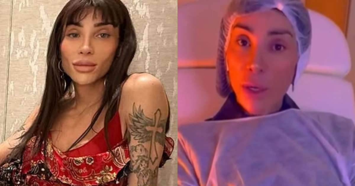 Maya Massafera choca ao mostrar resultado da cirurgia para mudar cor ...