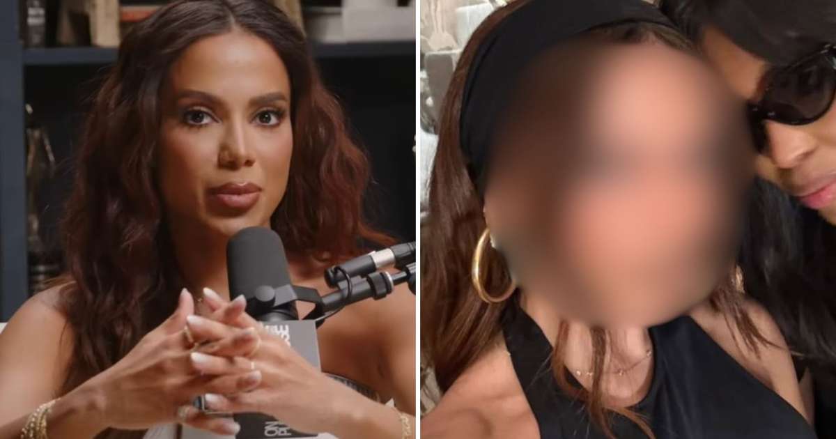 O que Anitta fez no rosto? Médicos descobrem procedimentos que mudaram ...