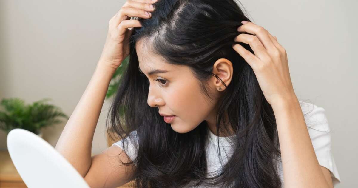 4 dicas para tratar a caspa sem agredir os cabelos