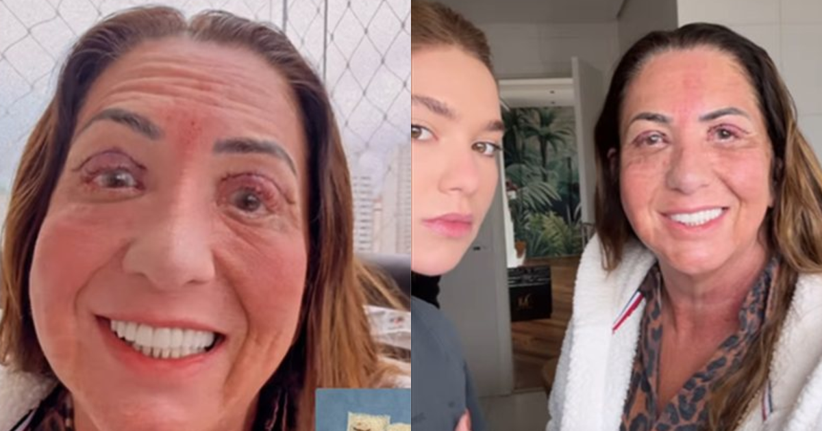 Mãe de Virginia faz cirurgia nos olhos e influenciadora choca web ao ...