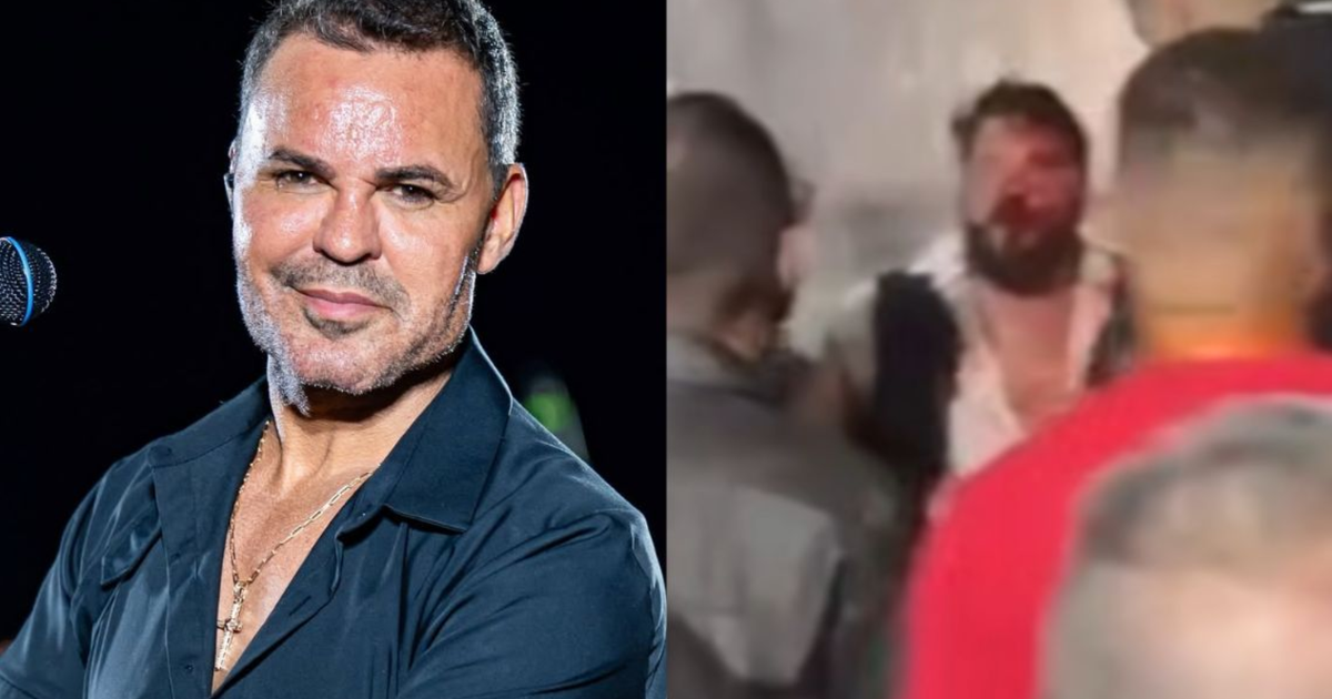 Cantor revela que foi agredido por produtor de Eduardo Costa: 'Covarde'