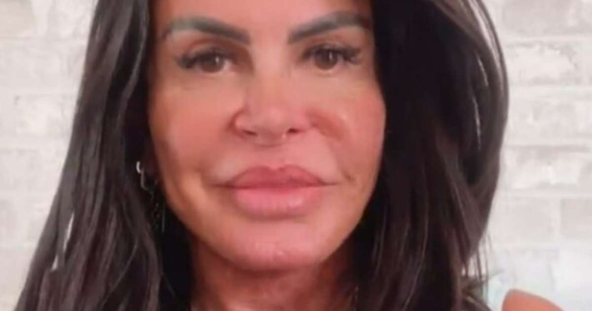 Gretchen mostra 'novo rosto' após procedimentos estéticos; veja