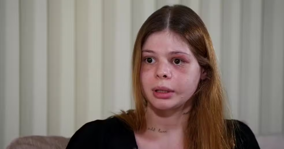 Médica agredida pelo namorado, diz que teve que fingir desmaio enquanto ...