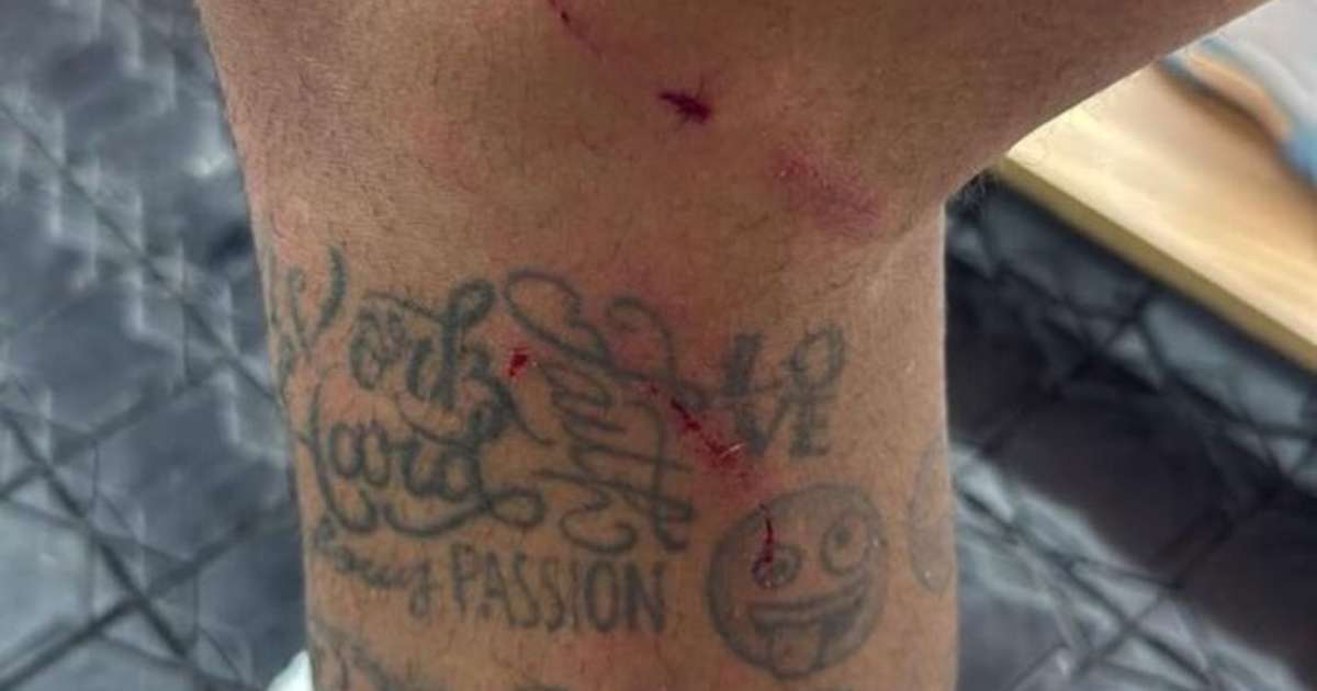 Neymar posta foto da perna machucada e ironiza arbitragem: 'Podem virar ...