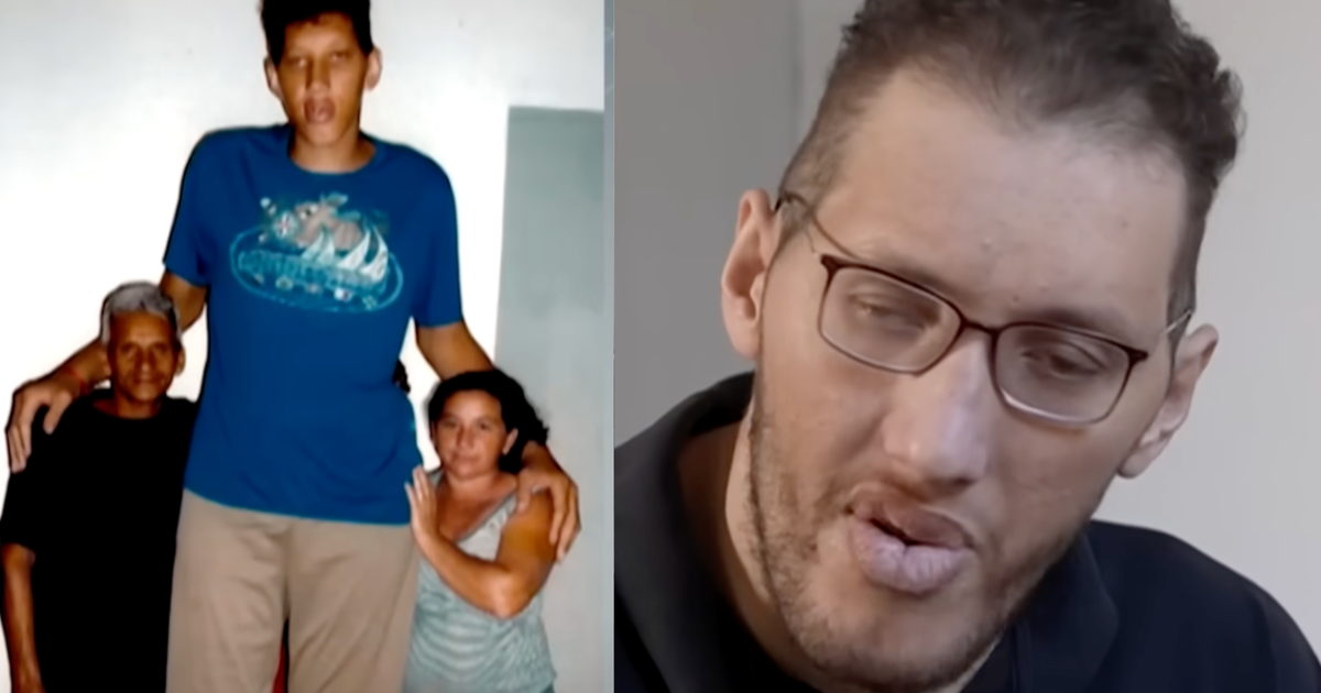 Homem mais alto do Brasil fala sobre risco de amputar a segunda perna; veja