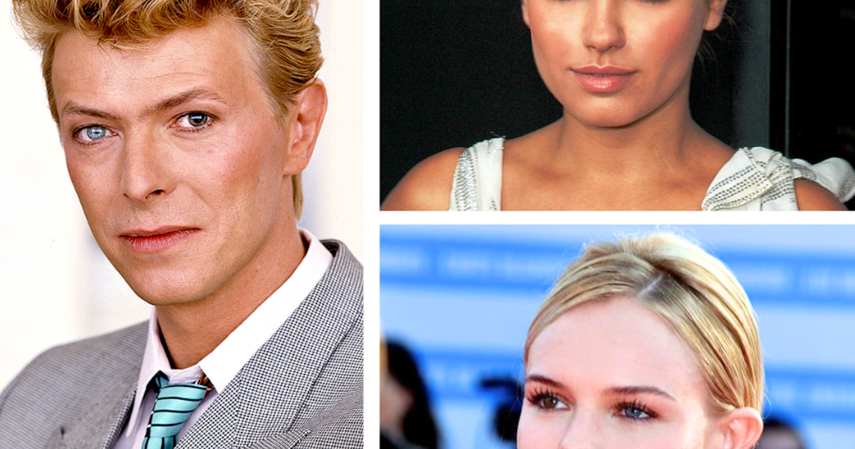 Negros, castanhos, azuis, verdes e até bicolores: conheça a ciência que ...