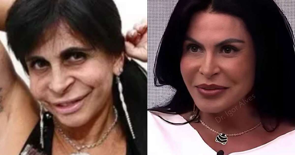 Gretchen detona quem fala sobre sua aparência