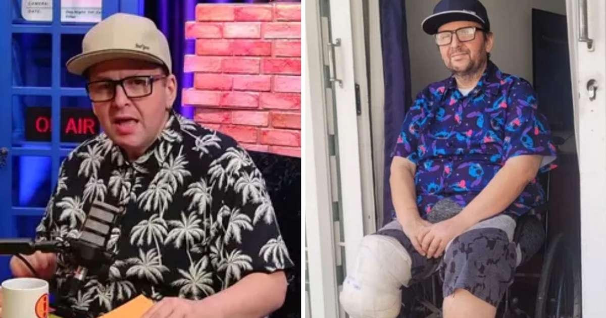 Humorista David Castilho, ex-'A Praça É Nossa', revela amputação de ...