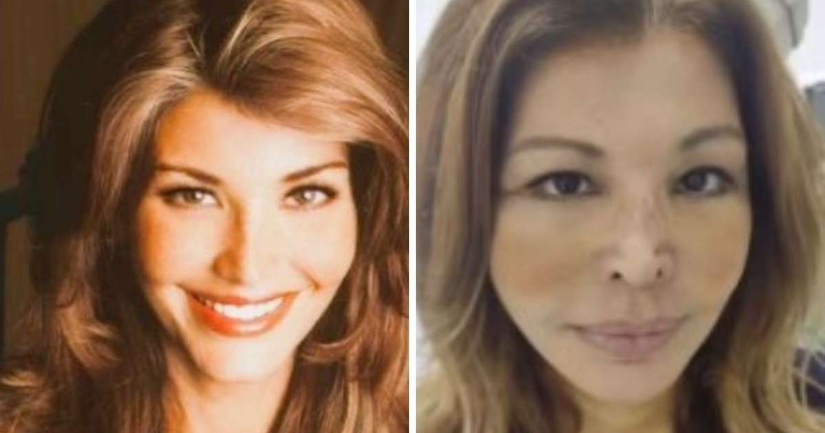 Musa dos anos 80, Roberta Close se rende a harmonização; confira