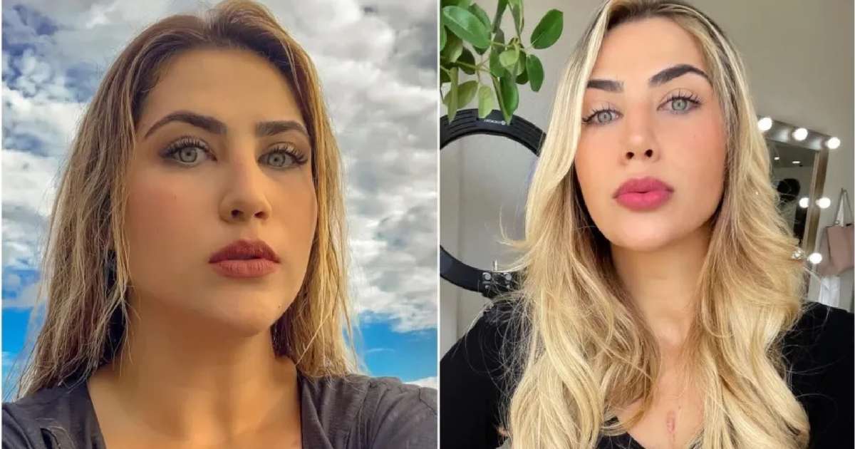 Doente? Filha de Leonardo posa na fazenda do pai e exibe cicatriz no peito