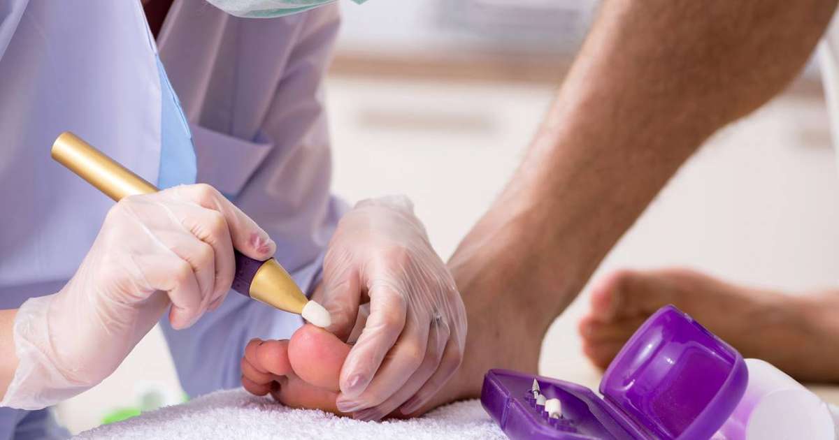 Fungo na unha? Como tratar. E veja cuidados para evitá-los