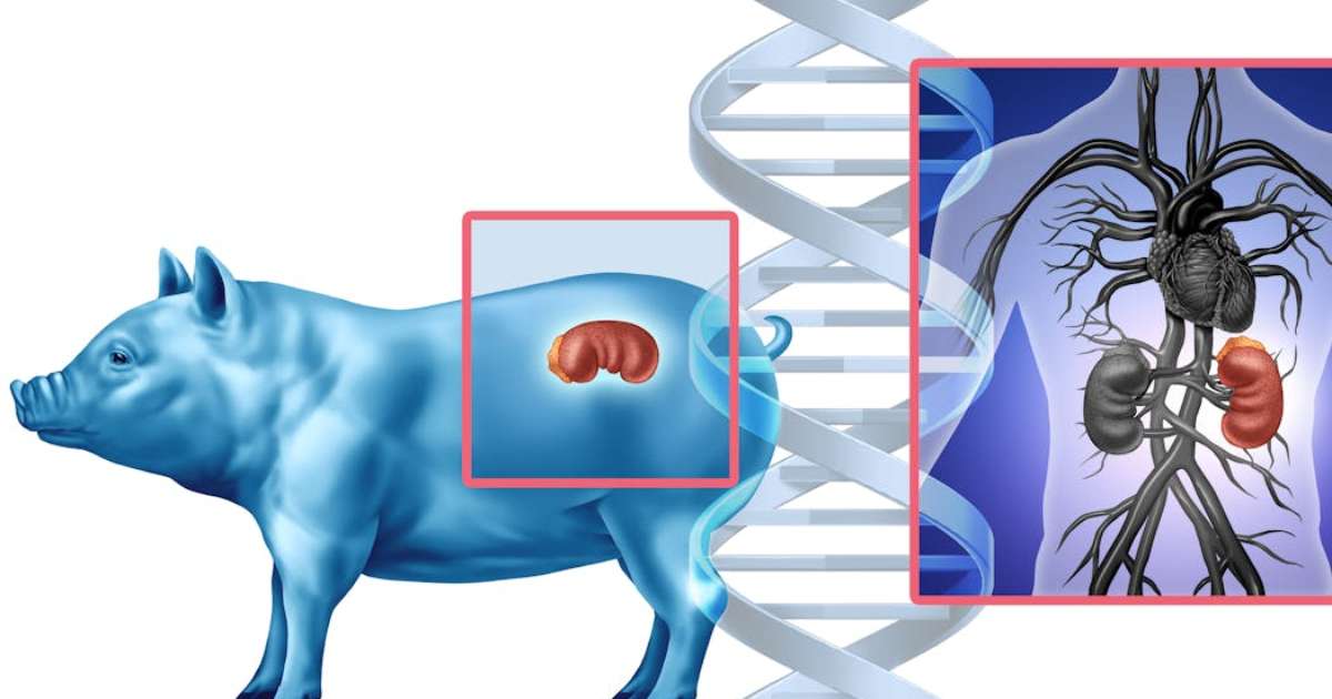 Por que colocar órgãos de porcos em pessoas é aceitável, mas cultivar ...