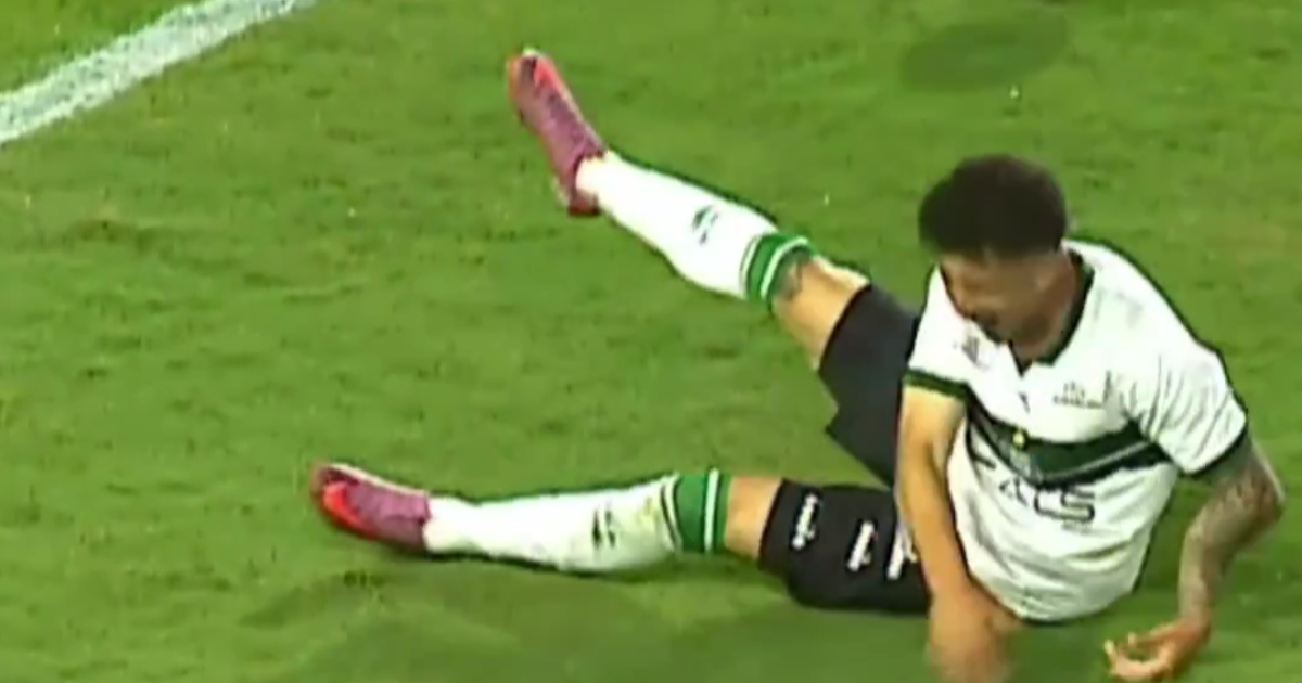 Atacante do Coritiba quebra o braço em estreia no Paranaense