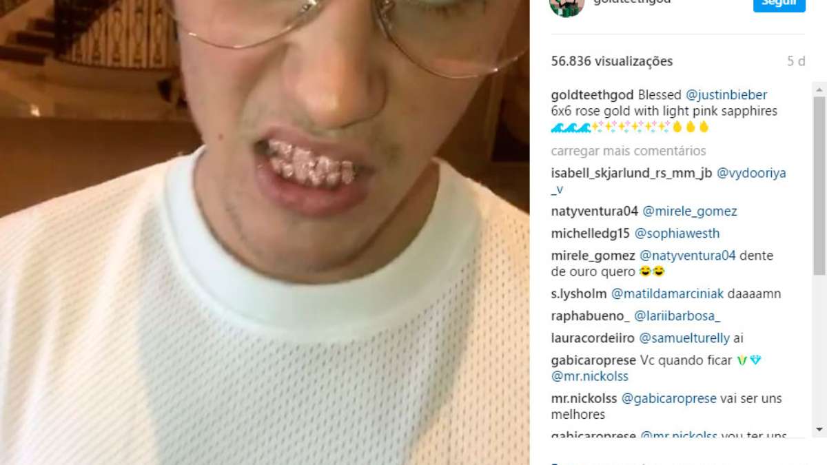 Justin Bieber Gold Teeth