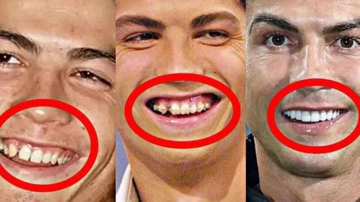 Cristiano Ronaldo 2002 Teeth