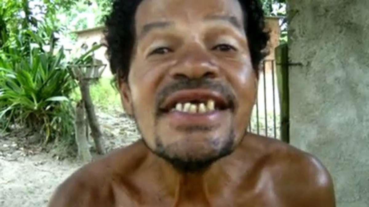 Homem sem dentes canta Kid Abelha e vira sensação