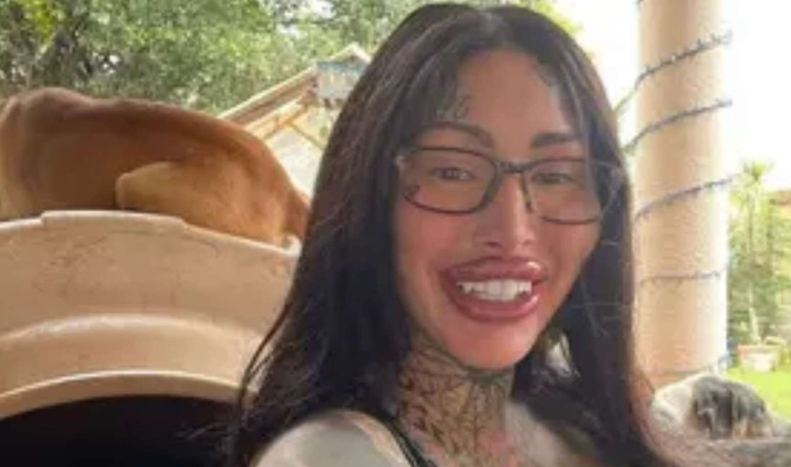 Influencer 'viciada em plásticas' quase morreu para bater recorde inusitado