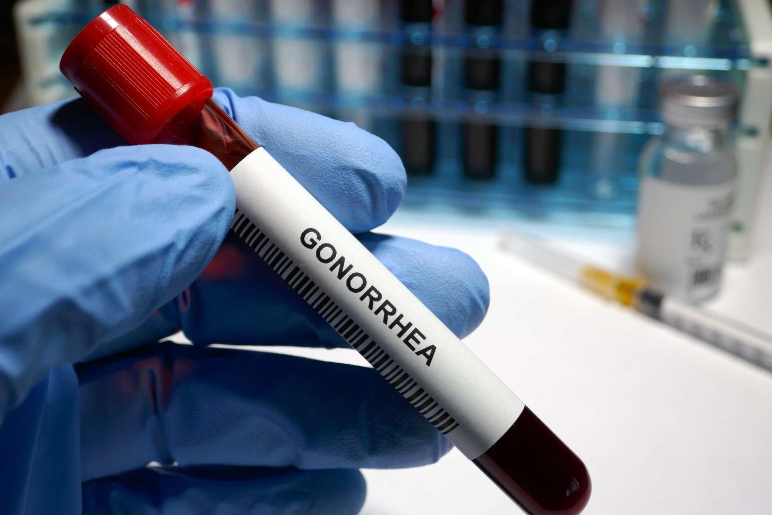 Gonorreia: o que é, tipos, sintomas, prevenção e tratamento