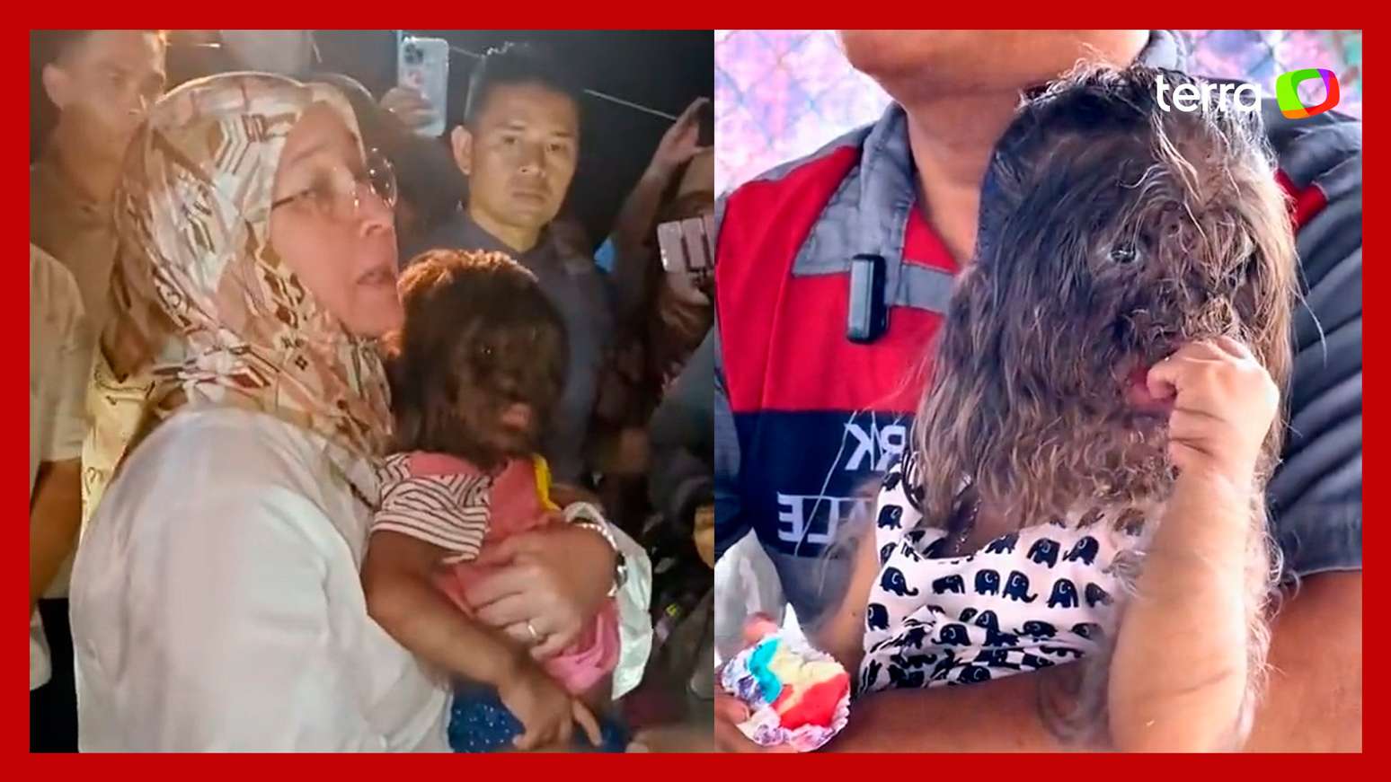 Vídeo de menina de 2 anos com síndrome rara viraliza nas redes sociais ...