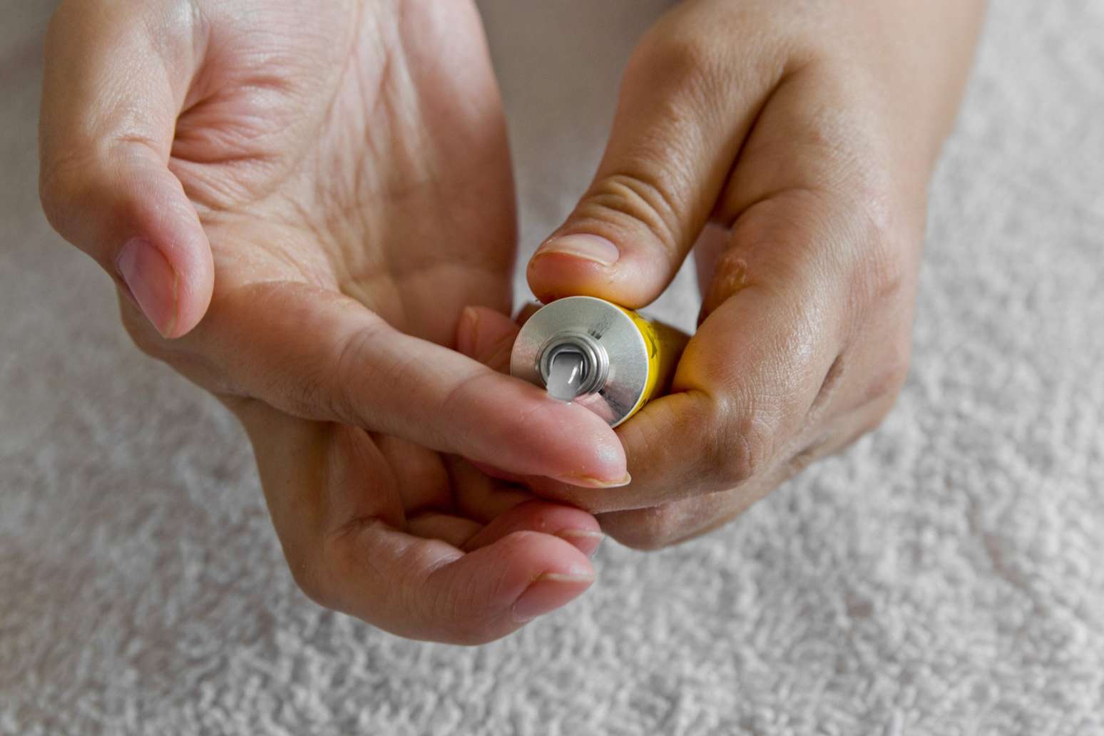 Pomadas para dermatite: 5 tipos diferentes e quando são recomendadas