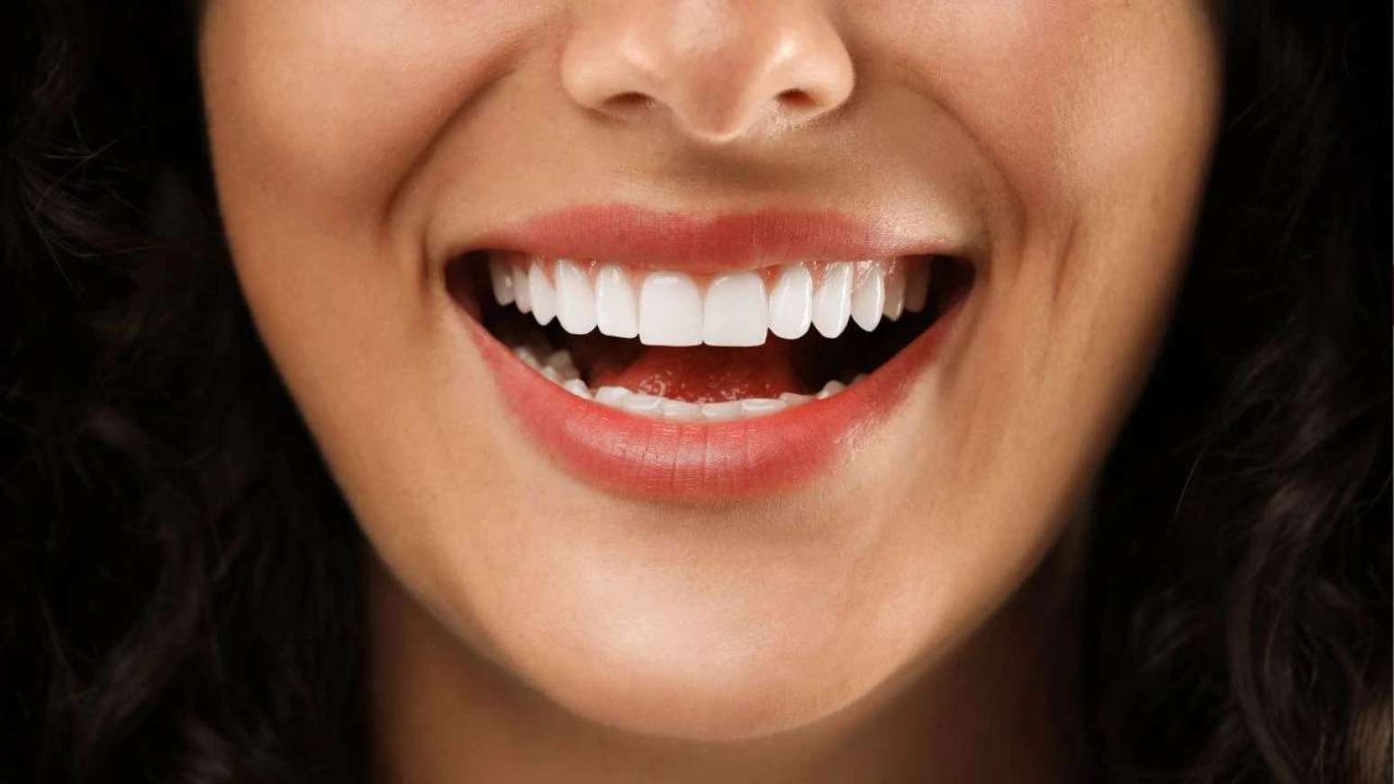 Sorriso perfeito! 5 dicas para cuidar dos dentes e lábios