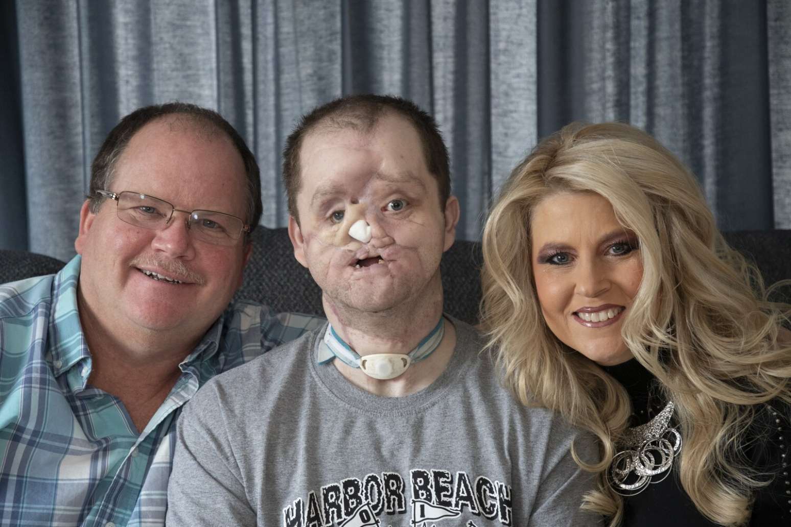 Homem passa por transplante de rosto e recupera funções faciais após 10 ...