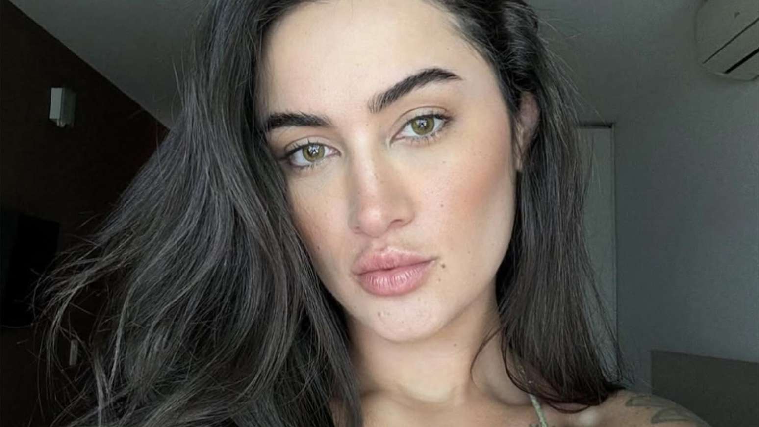 Paralisia de Gabi Melim pode deixar sequelas, diz médico