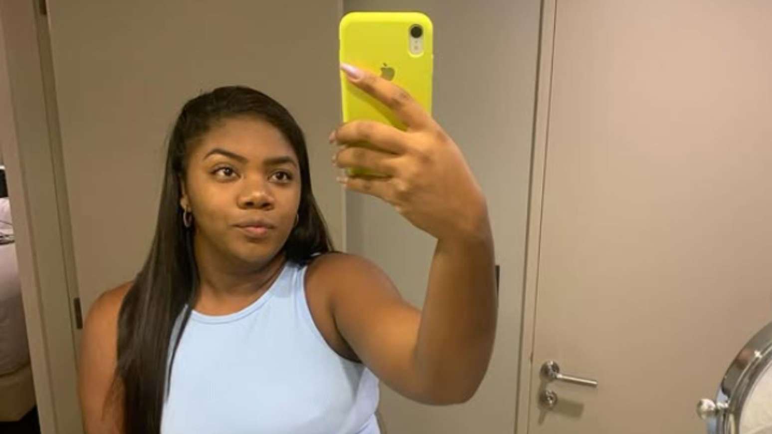 Raquel Brito surpreende em foto e revela procedimento: 'Resultado está ...