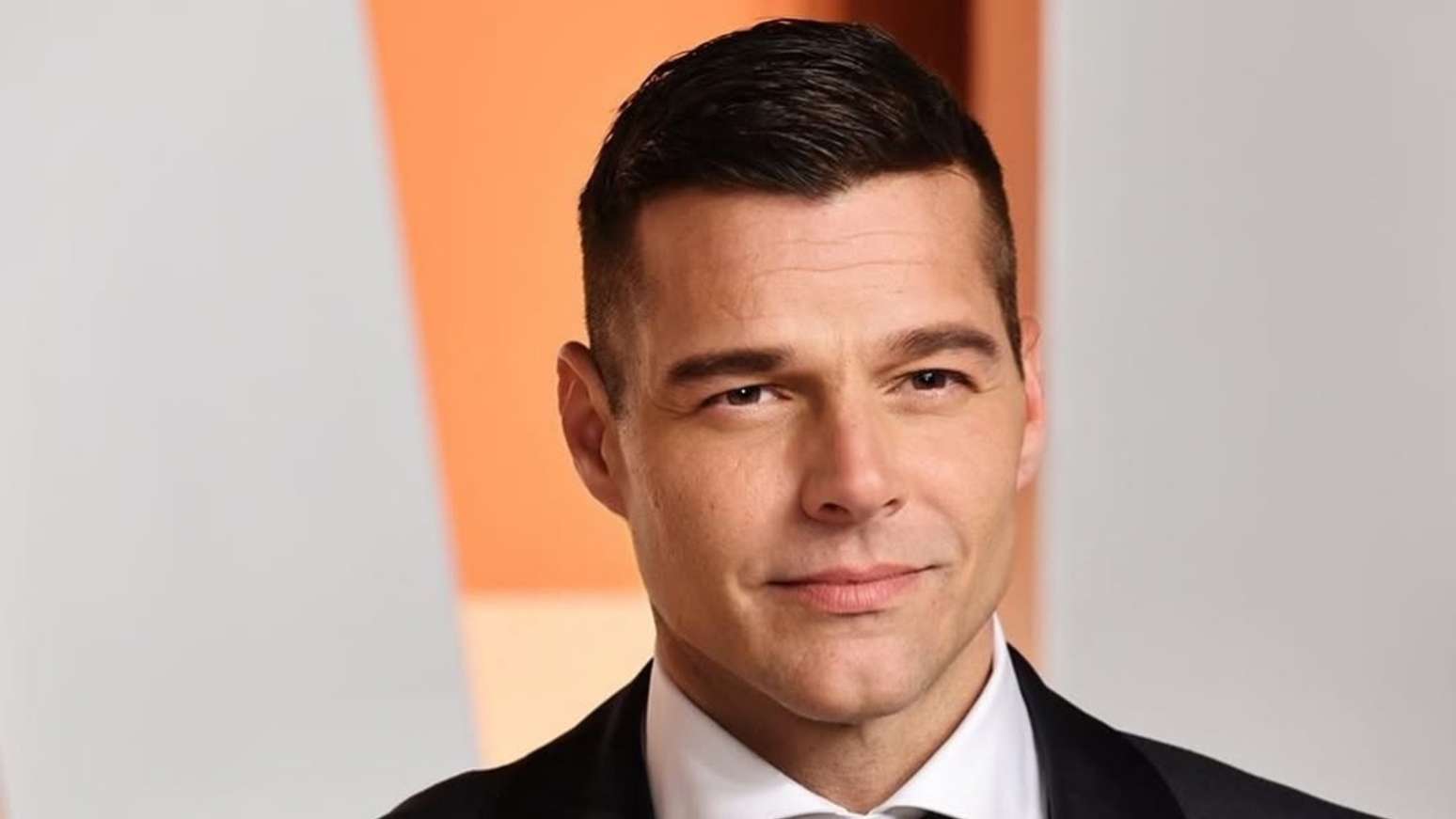 Especialista explica procedimento que rejuvenesceu Ricky Martin ...