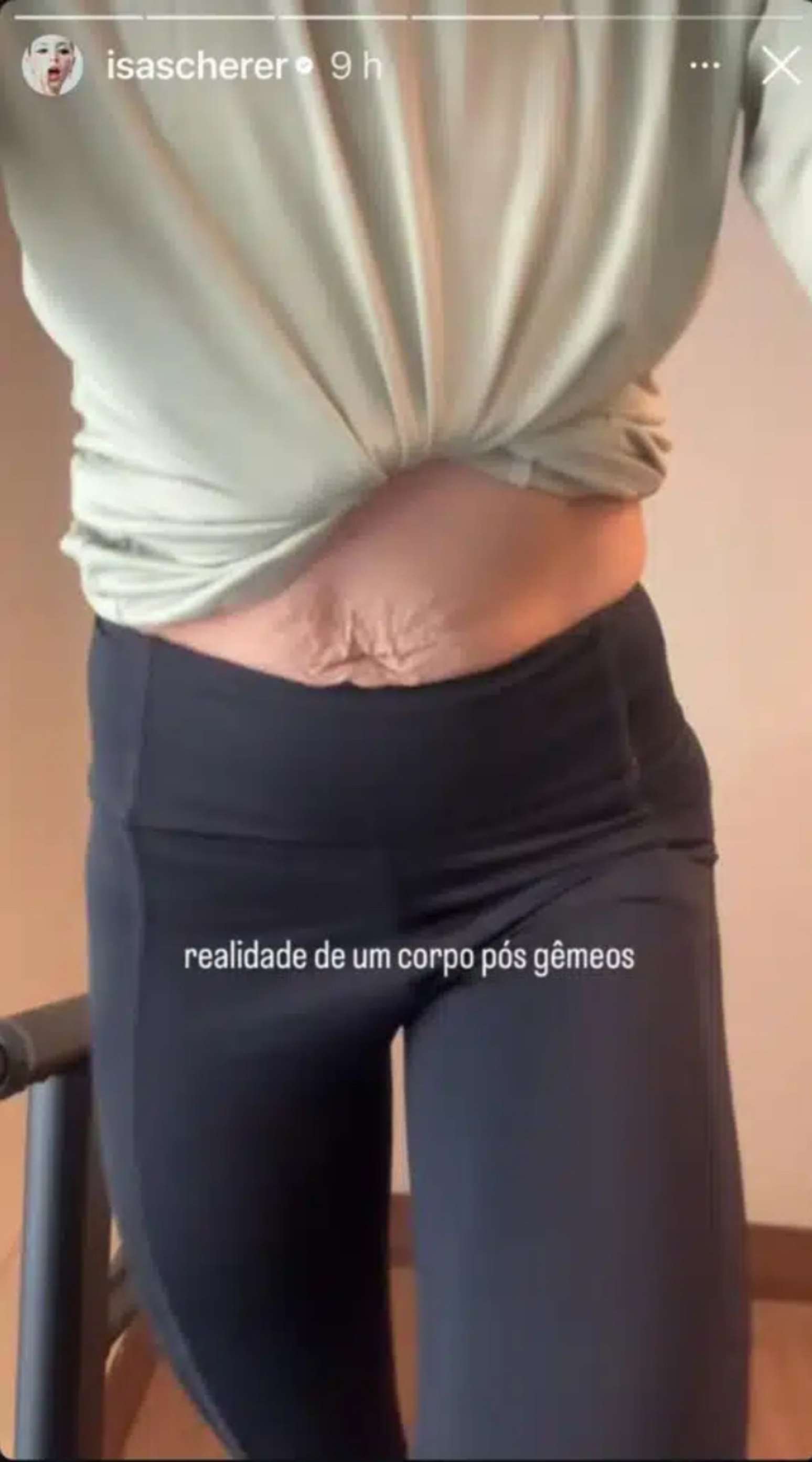 Dois anos após dar luz a gêmeos, Isa Scherer exibe barriga: 'Realidade'