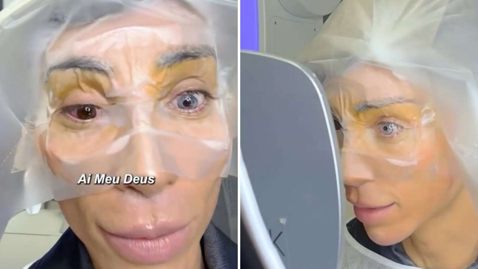 Maya Massafera exibe resultado da cirurgia para mudar a cor dos olhos ...
