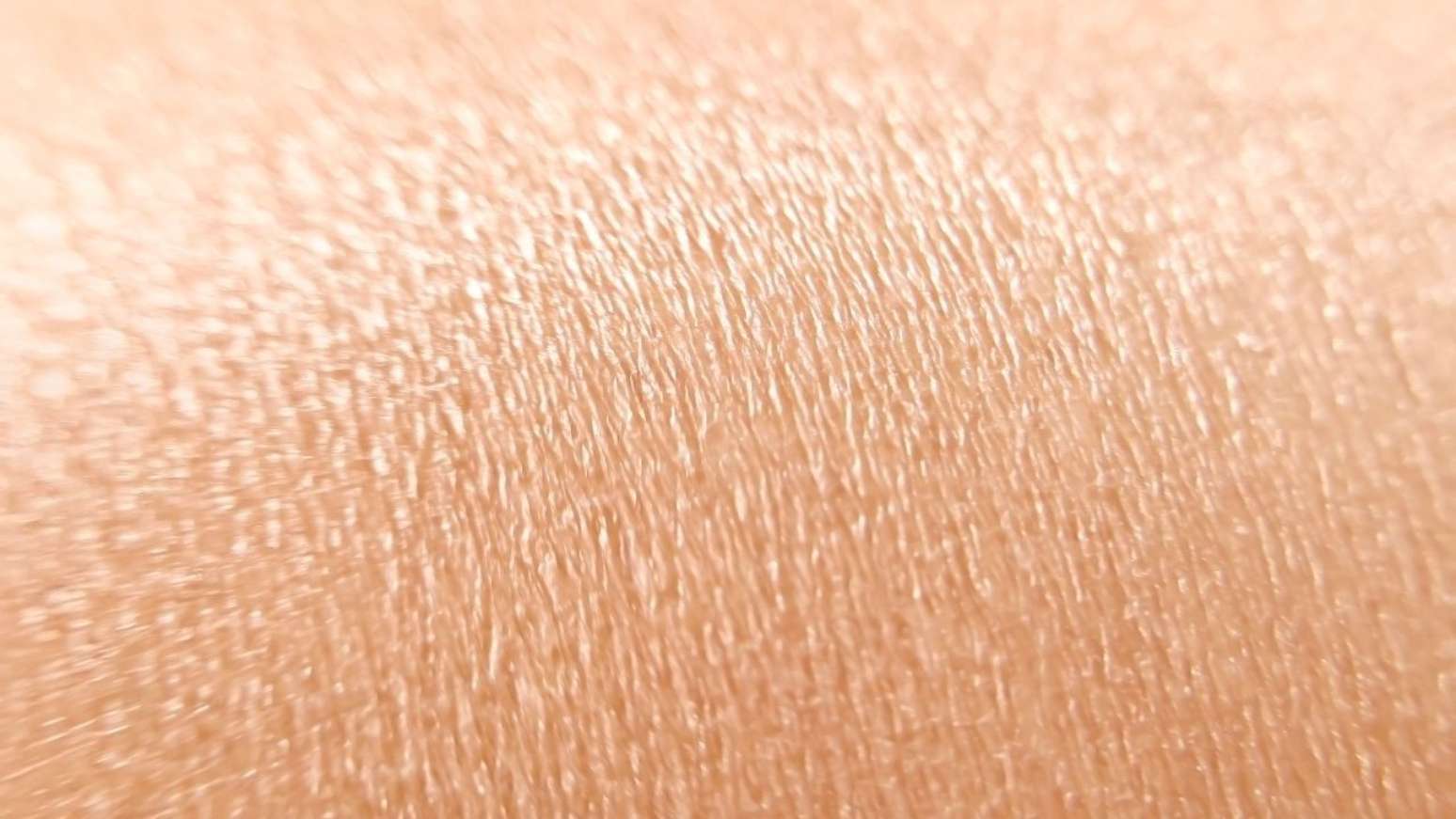 Pele descascando? Entenda causas e como evitar o problema no frio