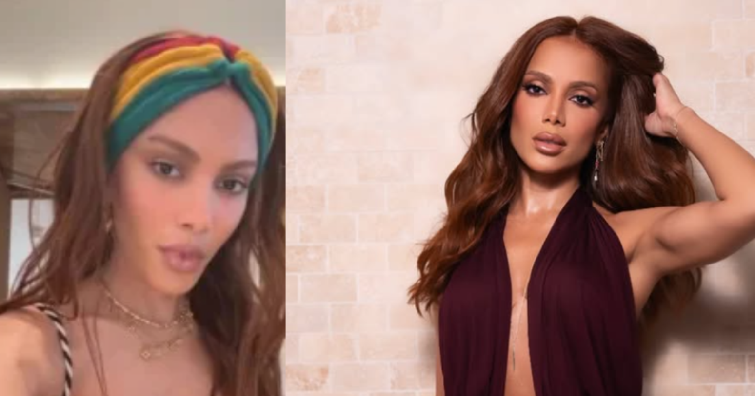 Anitta exibe novo visual após procedimentos e limita comentários
