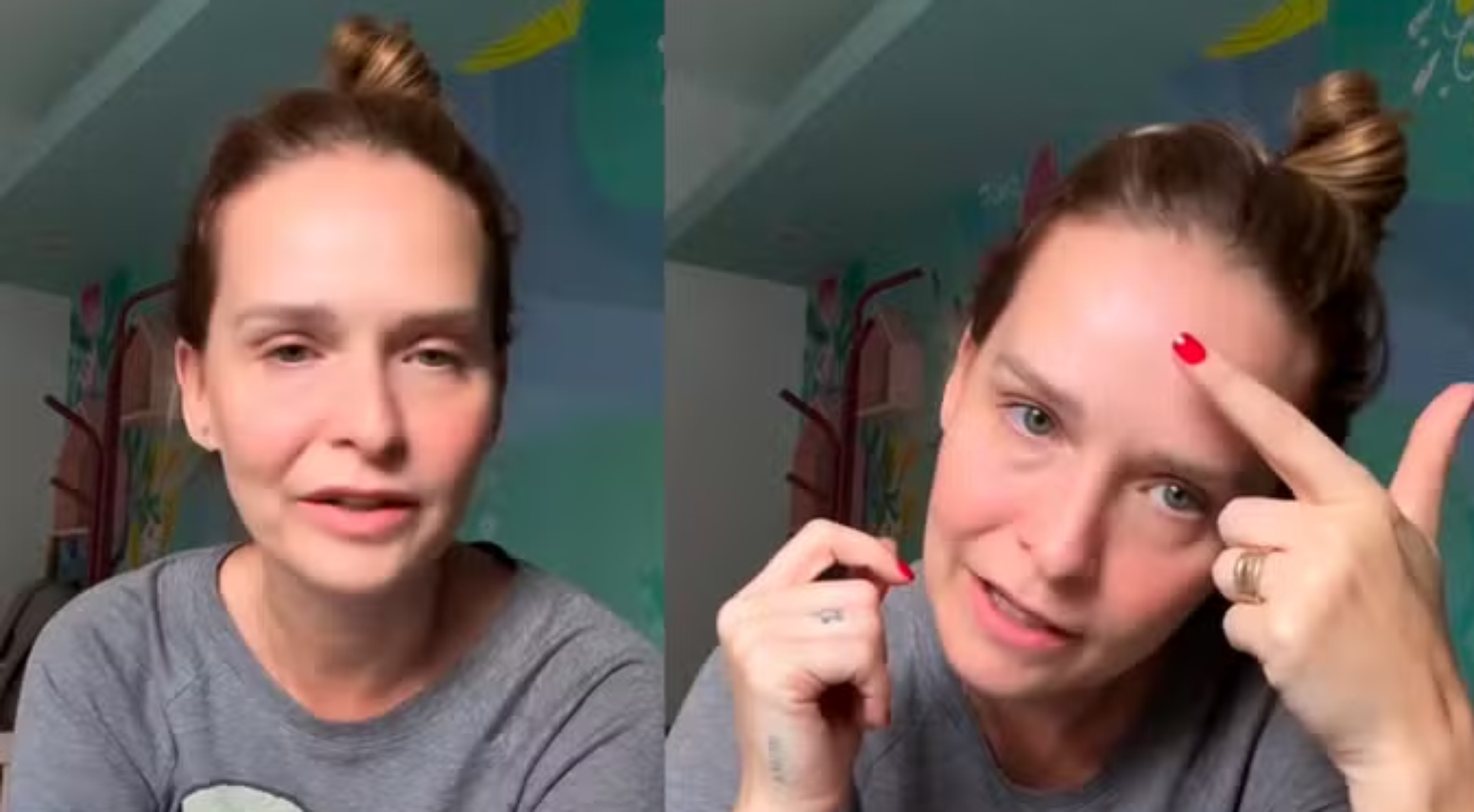 Fernanda Rodrigues revela volta de carcinoma e alerta para cuidados com a pele