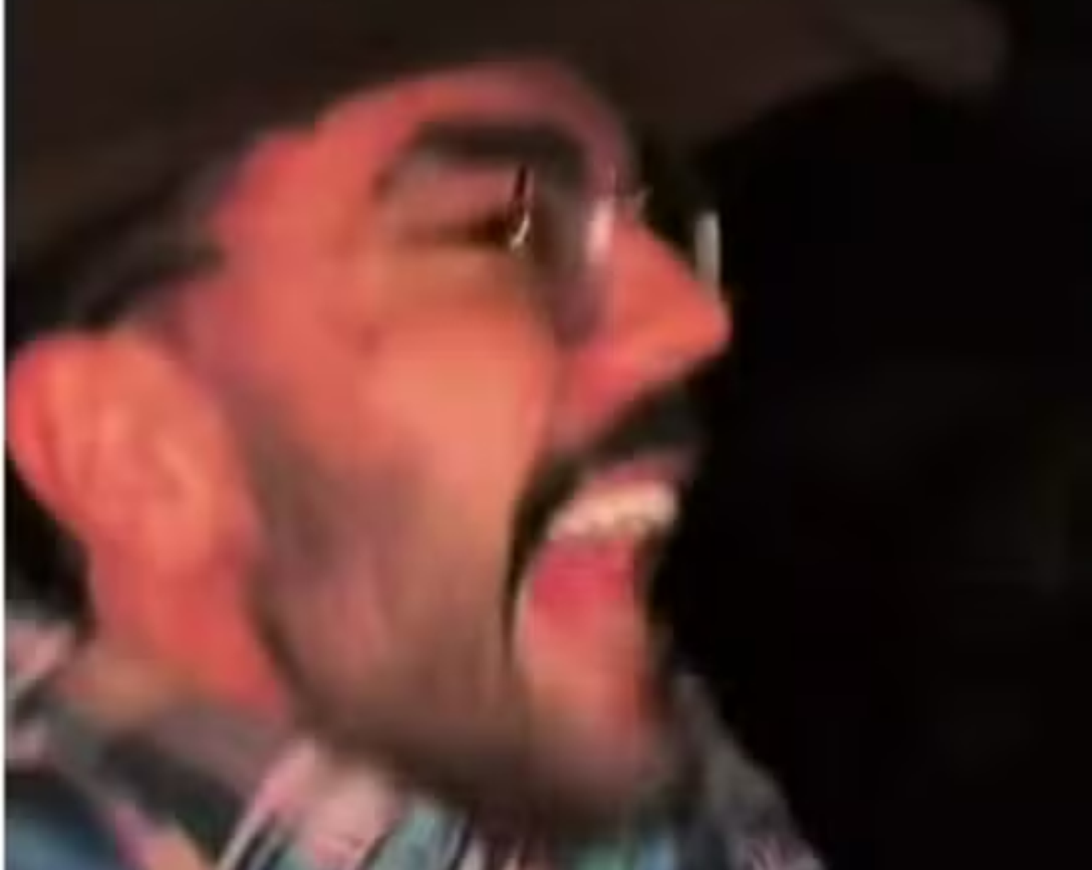 Machucado em rosto de Luan Pereira chama atenção após crise entre Dado ...