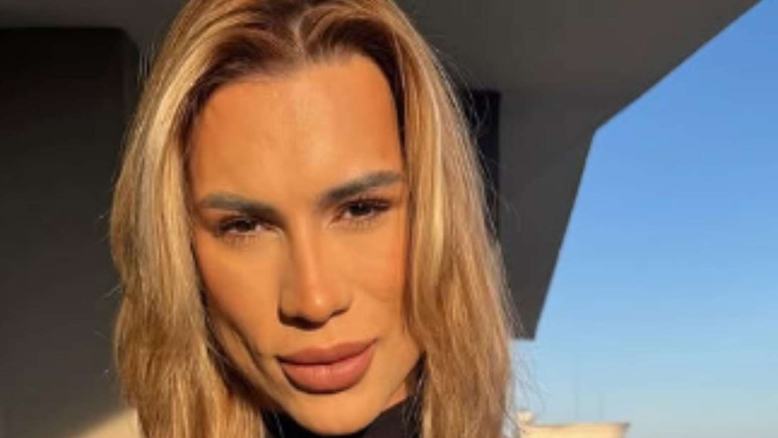 Quem era o influenciador que morreu após procedimento estético