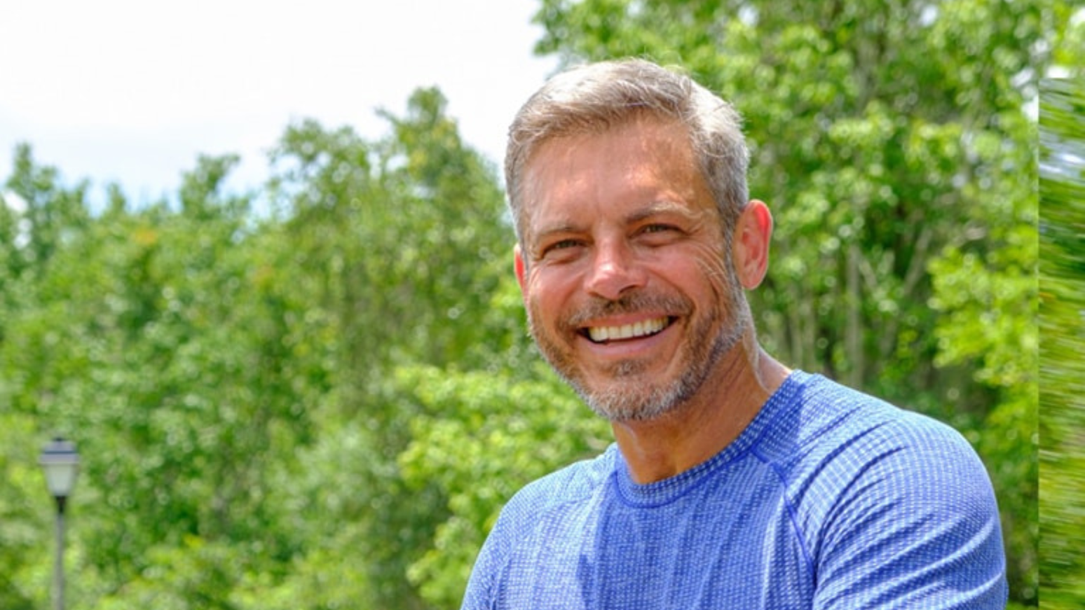 Luigi Baricelli passa por harmonização facial; veja antes e depois