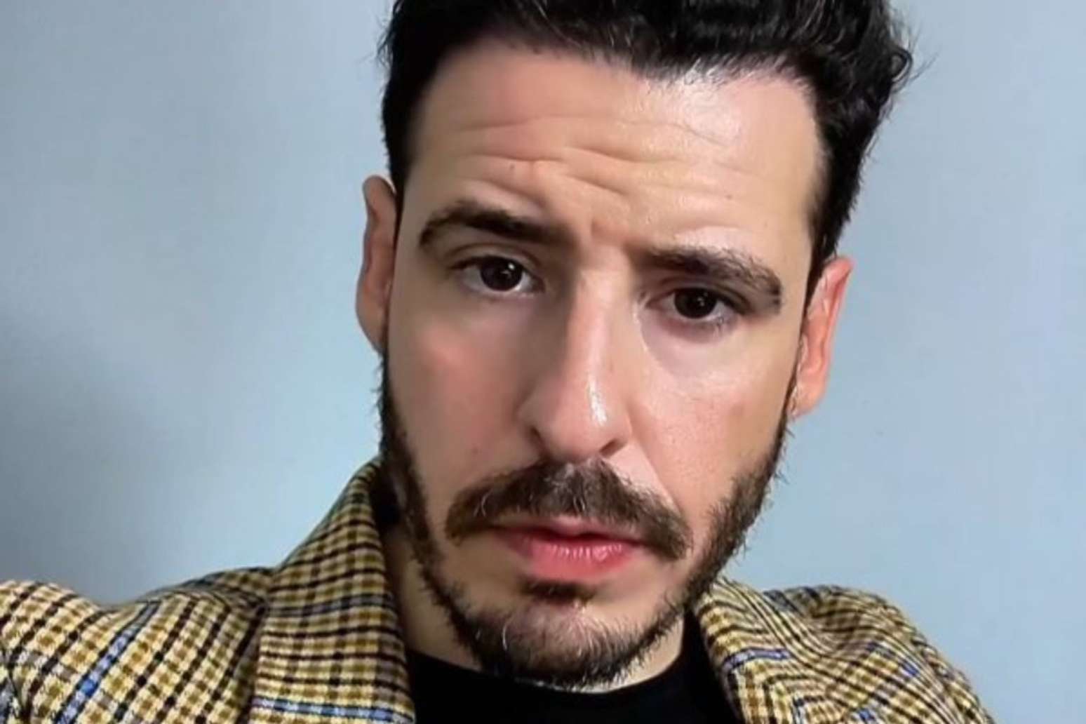 Thiago Schutz, 'Calvo do Campari', é liberado após agredir a namorada